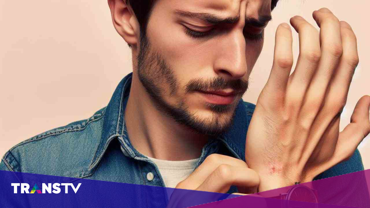 Mengatasi Darah Manis Agar Tak Menjadi Parah Di Kulit - Trans TV